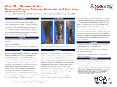 "When Skin Necrosis Mimics: Diagnostic and Therapeutic Challenges of Ca ...