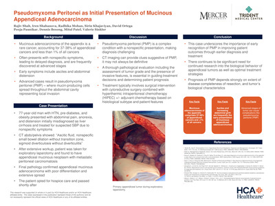 "Pseudomyxoma Peritonei as Initial Presentation of Mucinous Appendiceal ...